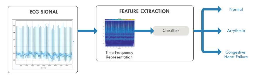 Biomedical Signal Processing - MATLAB & Simulink