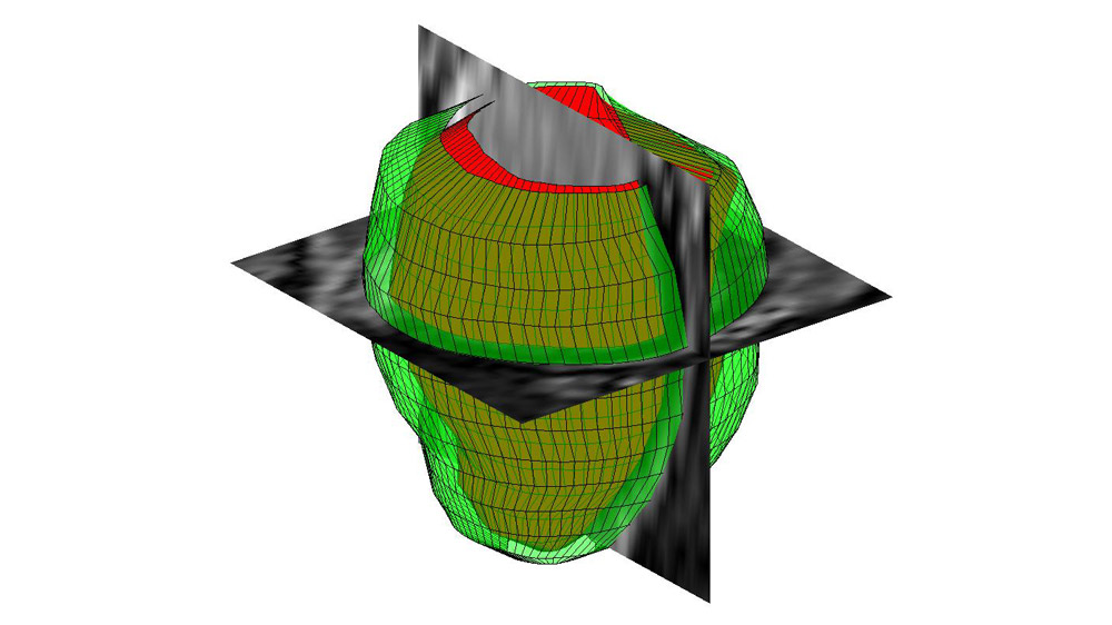 Six Types of Life Sciences Data and How to Process Them in MATLAB ...